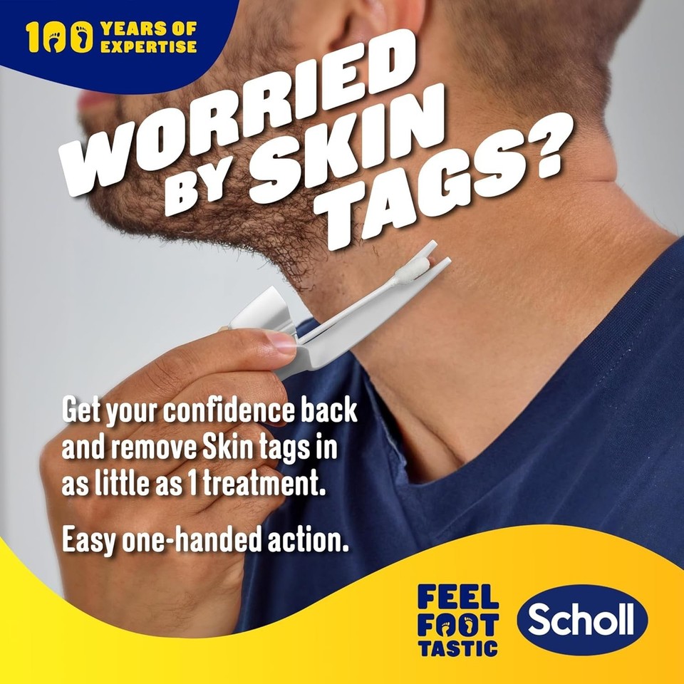 Scholl Freeze Away Skin Tag Removal Kit, Removes Skin Tags fast ...