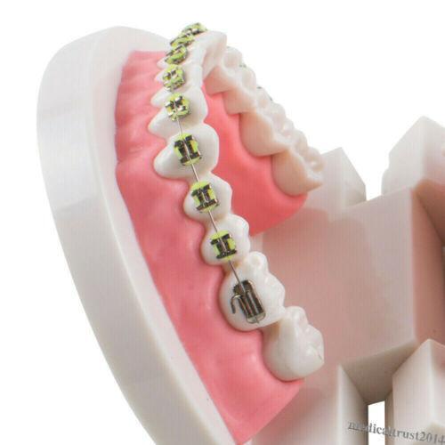Advanced Dental Teeth Model Set with Brackets and Gum Guide for ...