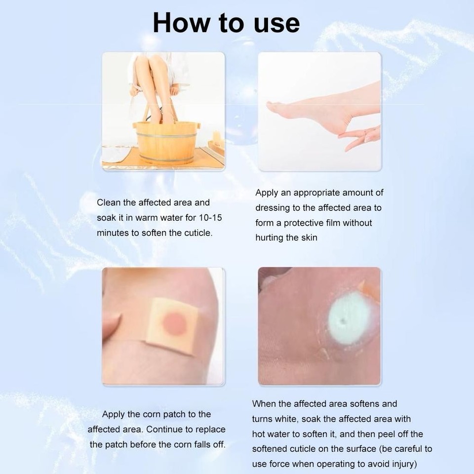 12Pc Foot Corns Warts Removal Patch Pain Removal Removes Calluses ...