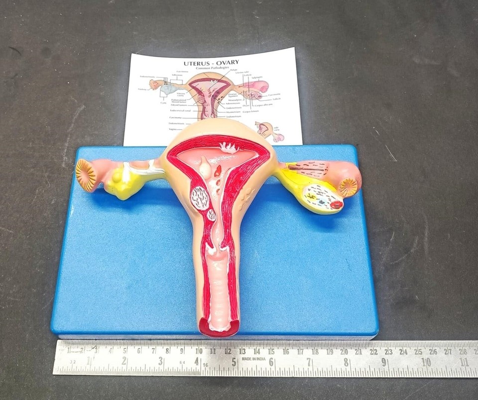 Uterus And Ovary Model Female Reproductive Organ Model Human Anatomy | eBay