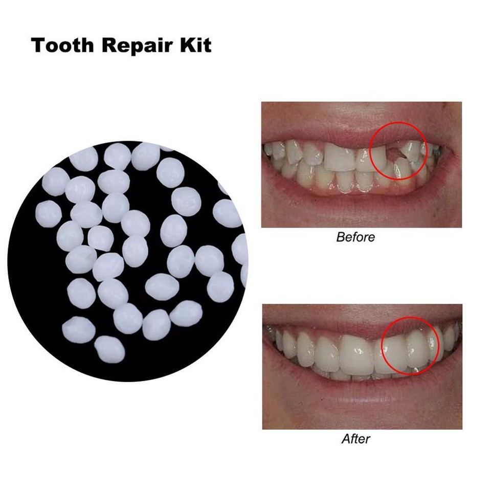 10/100g Dental Glue Handmade Solid Denture Glue Tooth Beauty Tool (10g ...