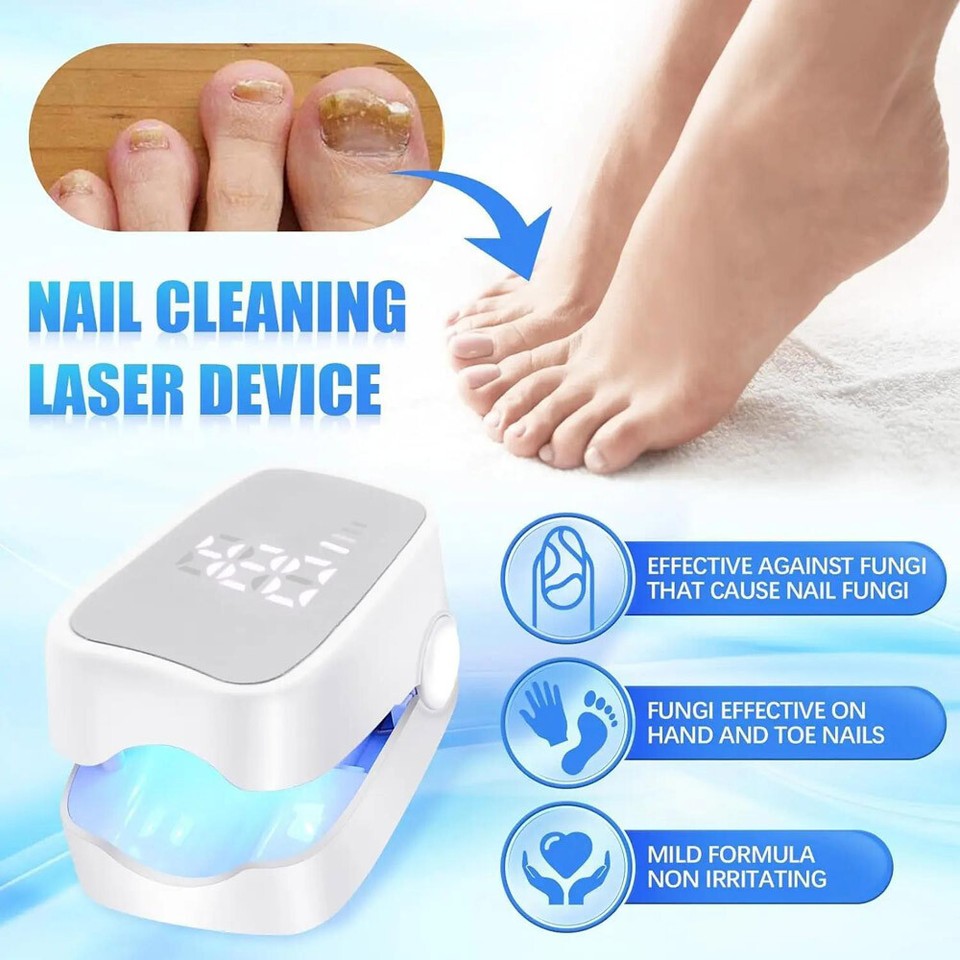 Nail Fungus Laser Treatment Device for Multiple Toenail Onychomycosis ...