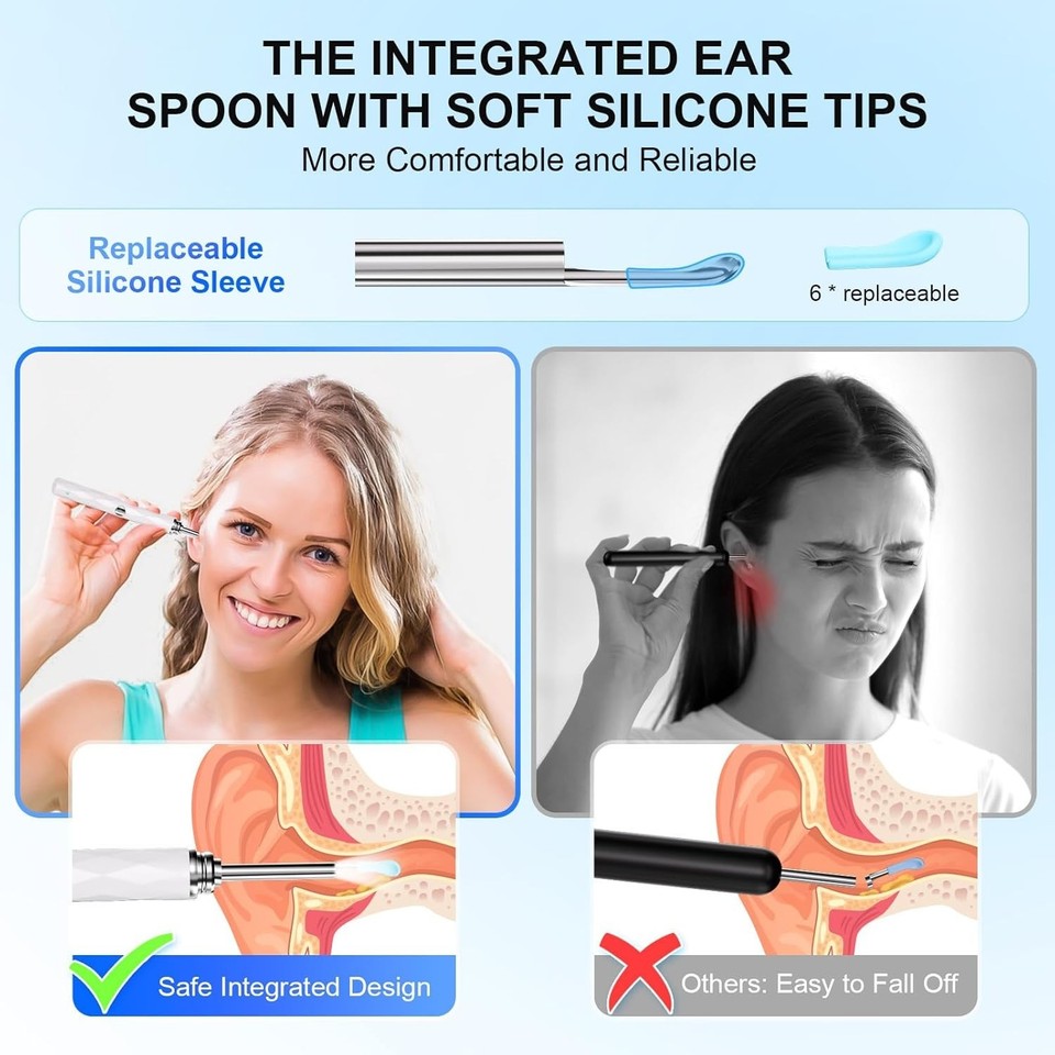 High-Definition Ear Wax Removal, Wireless Ear Cleaner, Safe and Gentle ...