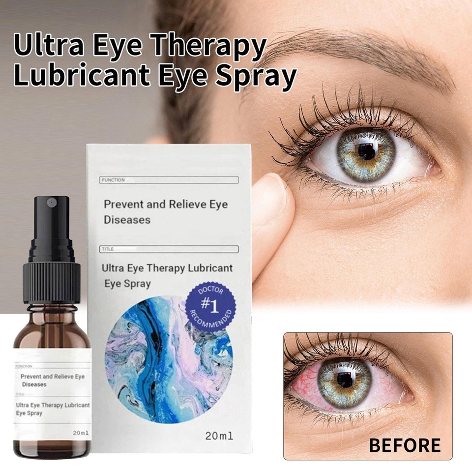 Eye Spray for Dry Eyes Natural Lubricating Eye Spray Dry Eye Relief ...