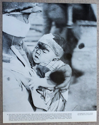 11x14 Photo Infant Baby Survivor Nagasaki Nuclear Atomic Bombing (A ...