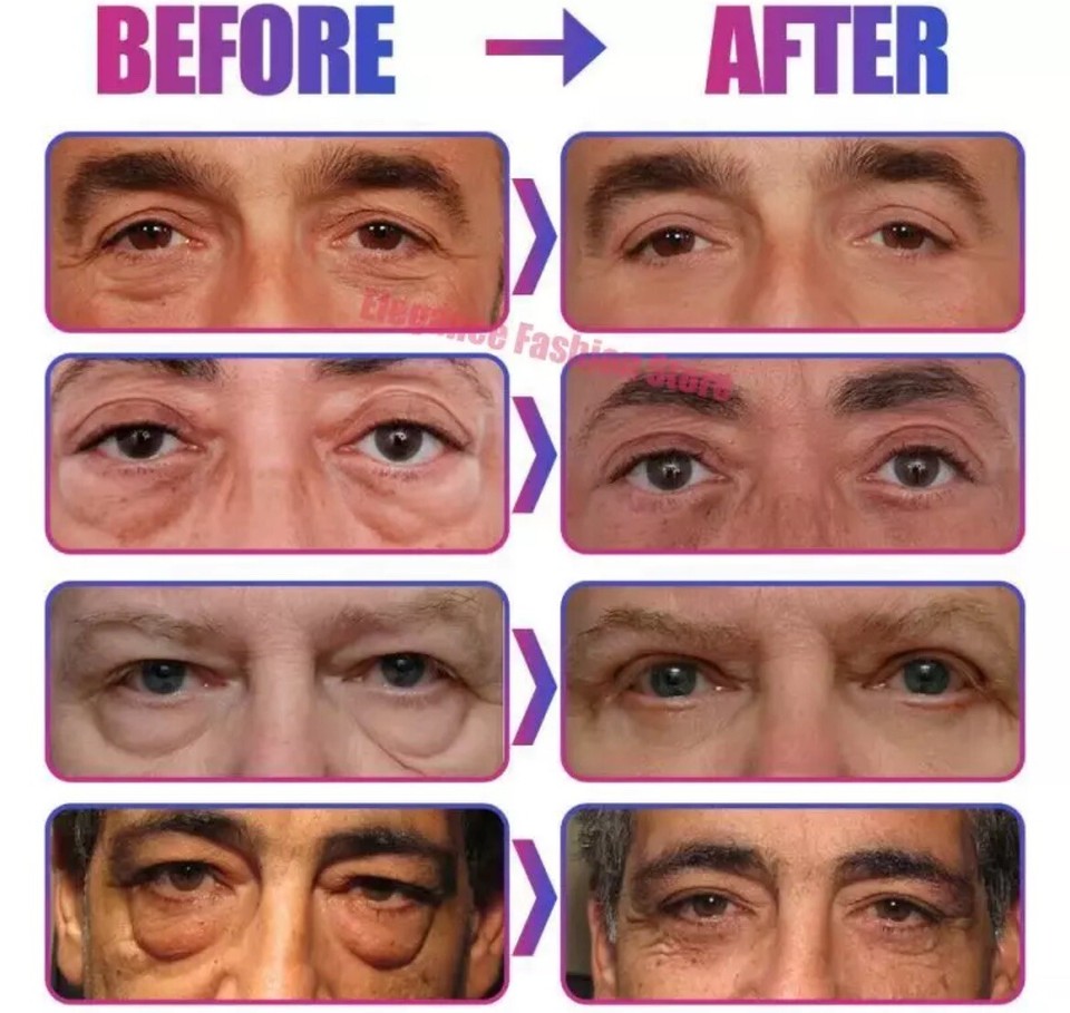 Instant Eye Bag Remove Eye Cream anti Fat Particles Dark Circles ...