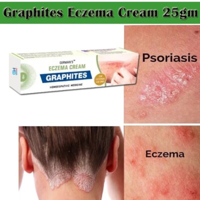 Health Care Psoriasis Cream Eczema Ointment Scalp Psoriasis Hand Tinea ...