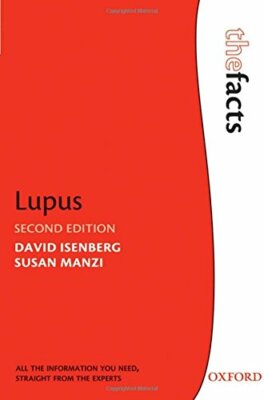 Lupus (The Facts) by Manzi, Susan Paperback Book The Fast Free Shipping ...