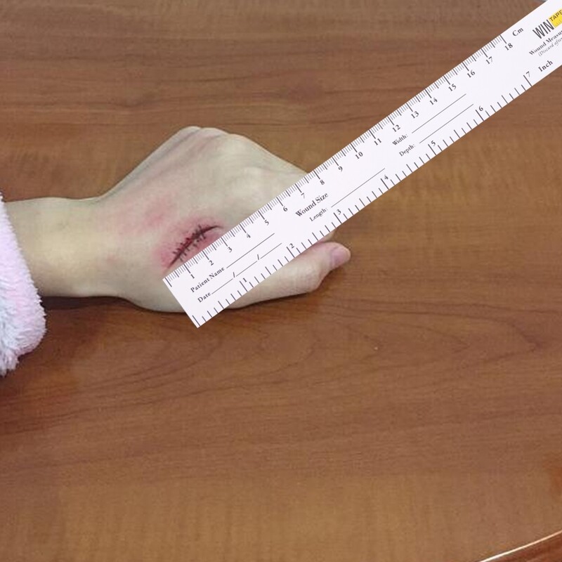 18cm / 7 Educare Wound Ruler /PAPER 18cm / 7 Wound Measuring Tape 100 ...
