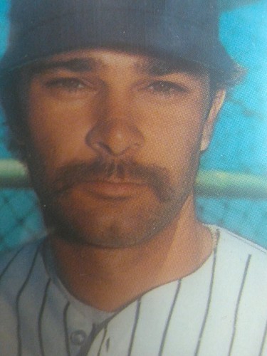 1987 Topps Tiffany Don Mattingly All Star Error Card PSA 8 double ...