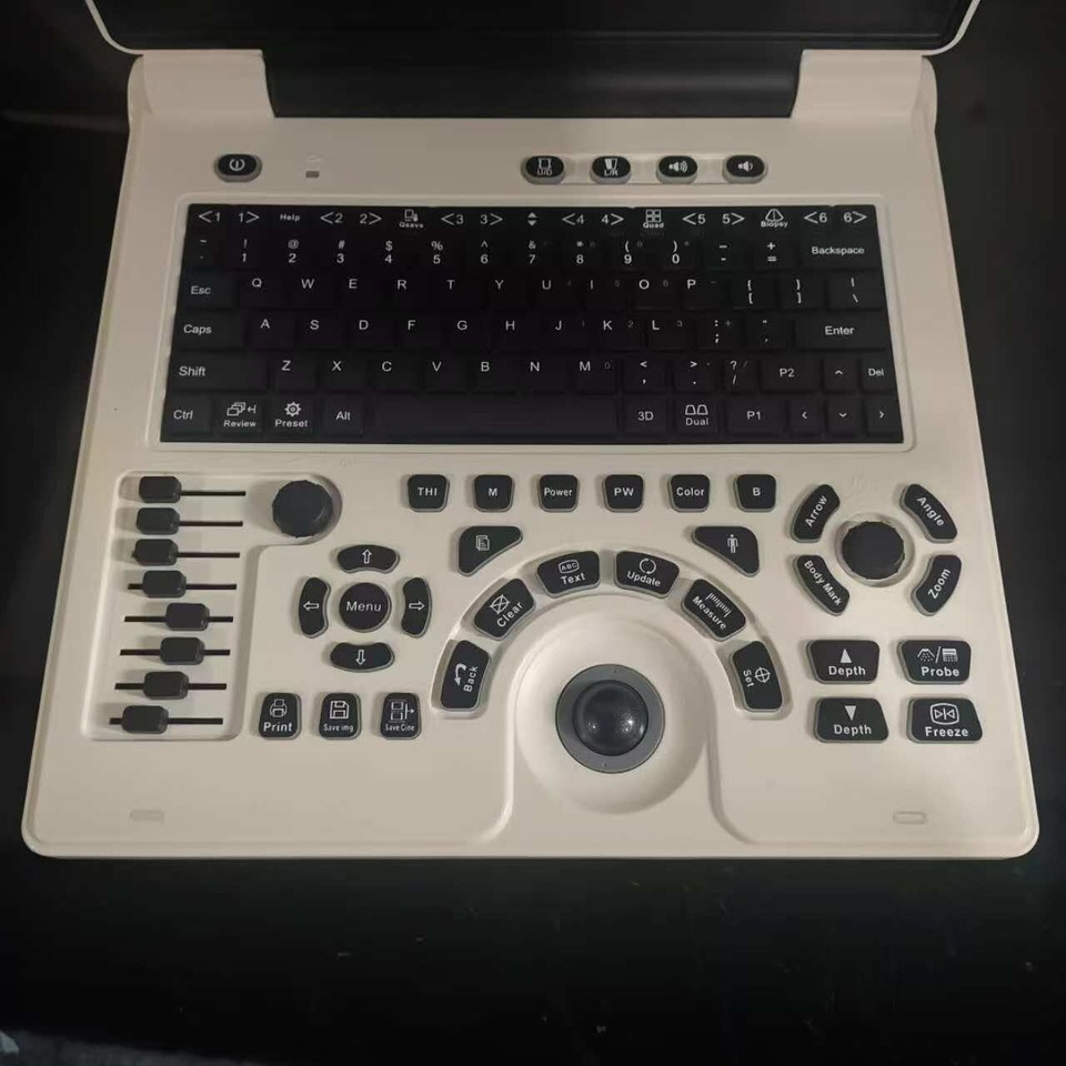 C2 12 Inch Laptop Ultrasound Machine Color Doppler Echo w/Convex Linear ...