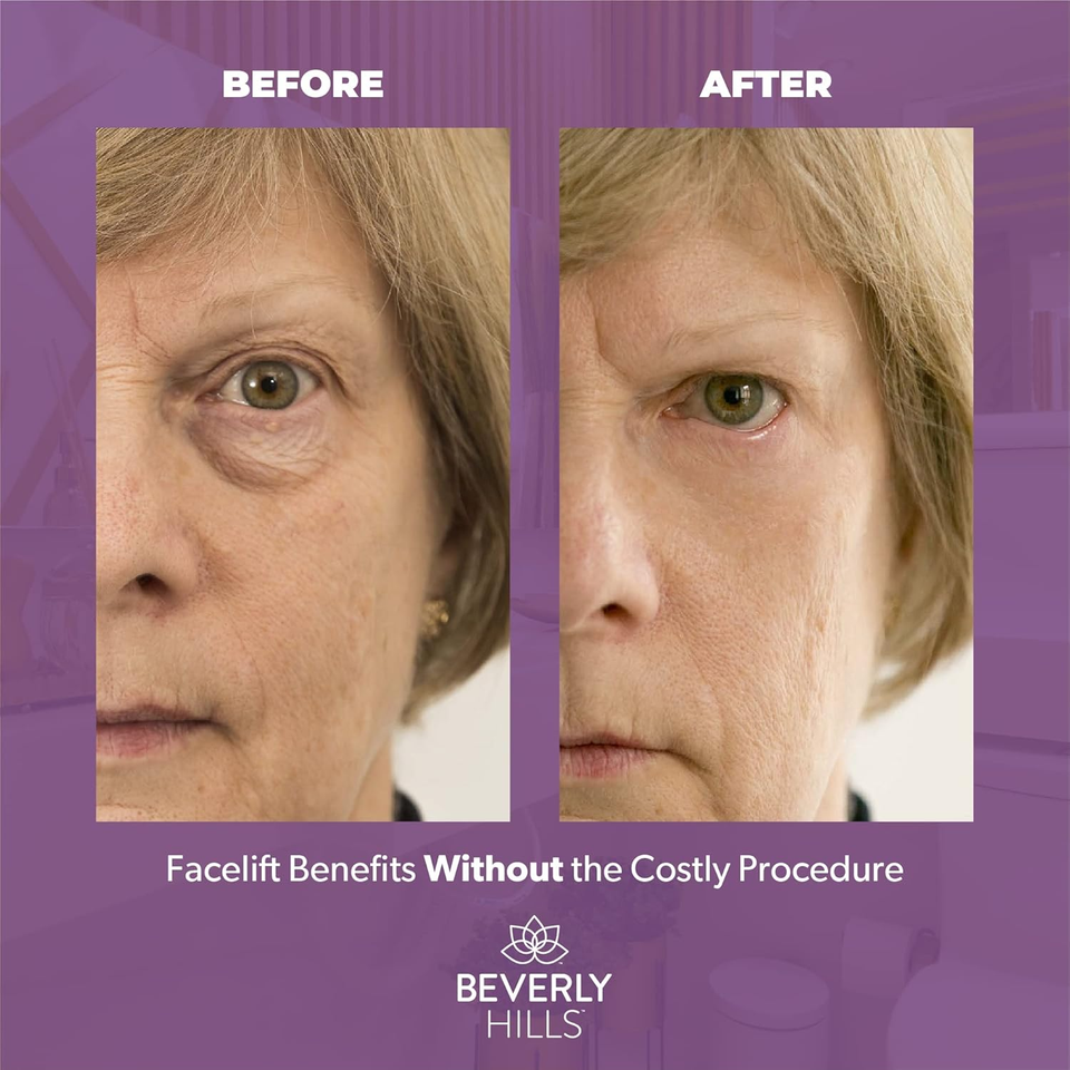 Beverly Hills V-Lift Instant Eye Lift and Eye Tuck Bee Venom Serum for ...