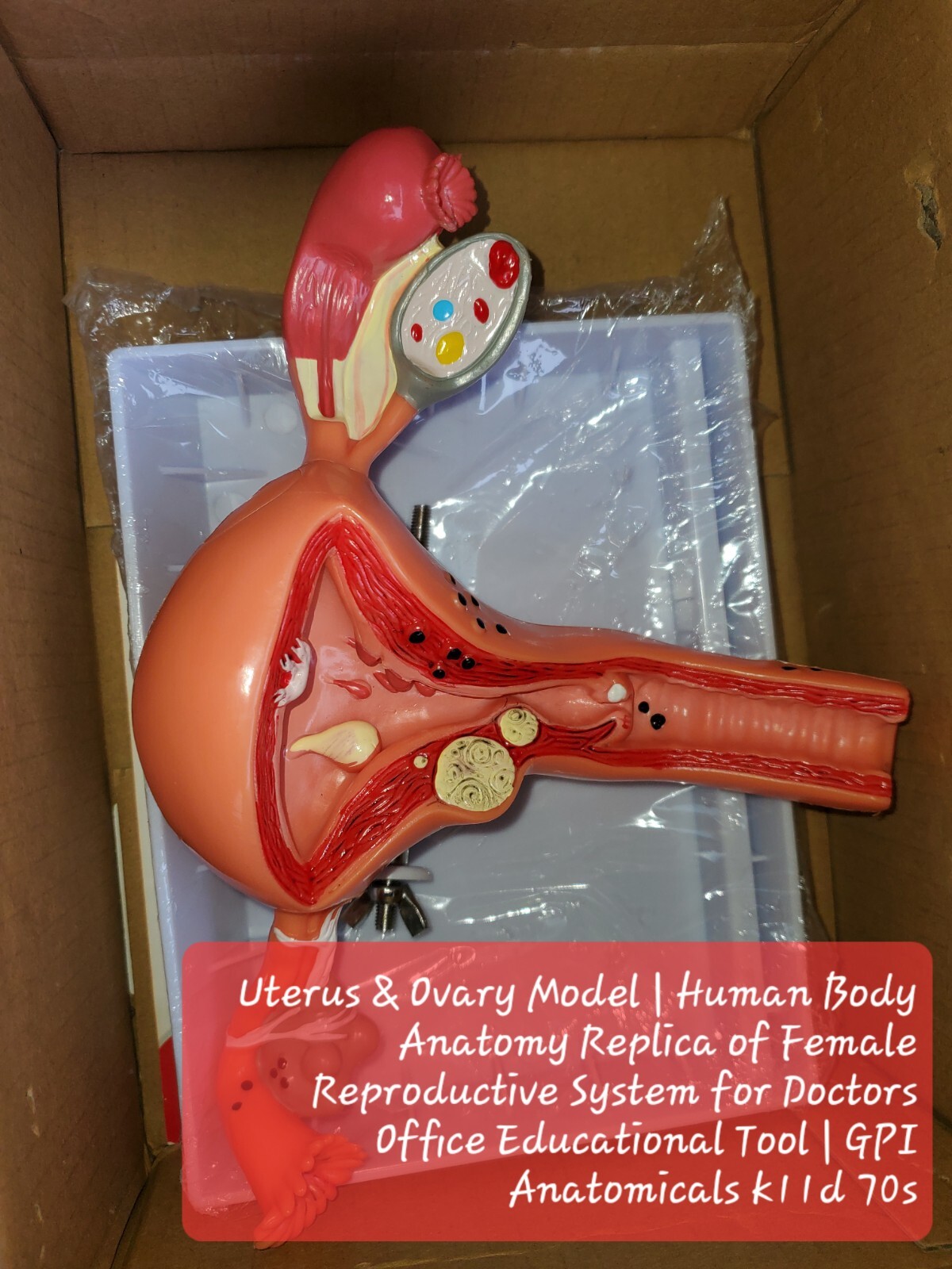 Uterus & Ovary Model | Human Body Anatomy Replica of Female ...