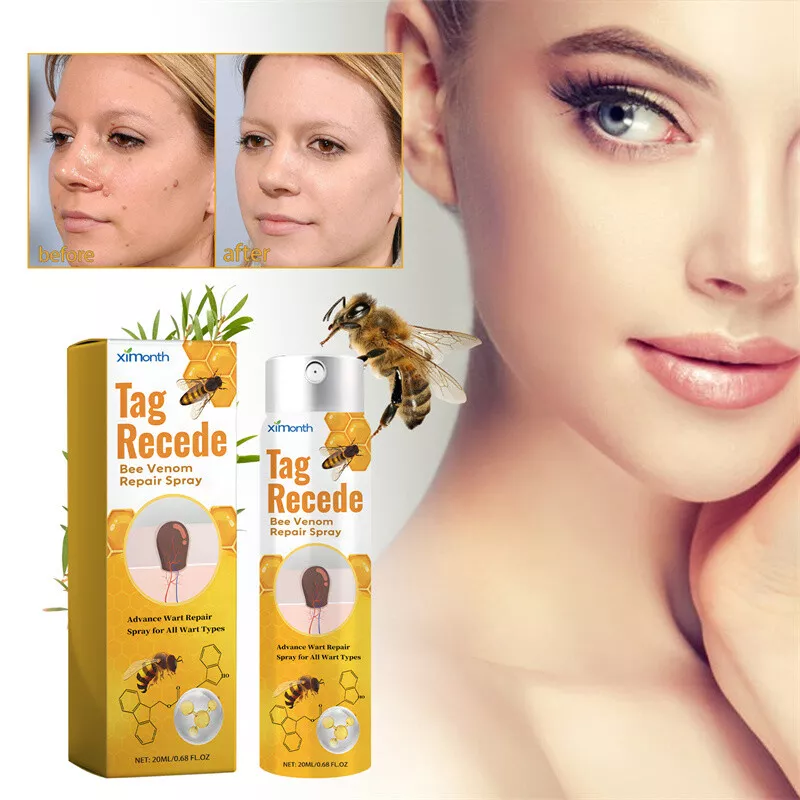2× Tag Recede Bee Venom Treatment Spray Tag Recede for All Skin Bee ...