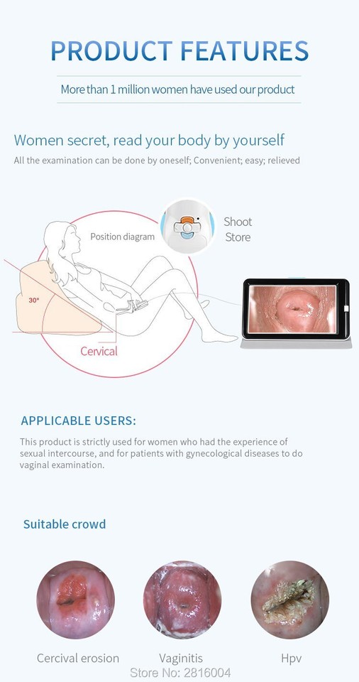 Digital Video Electronic Mini Colposcope FA2 3000 000 Pixels with ...