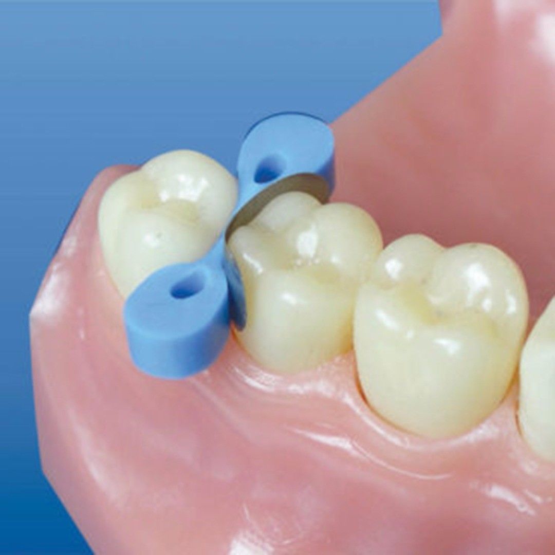 40 PCS Dental Elastic Fixing Wedges Matrix Matrices Rubber Dam ...