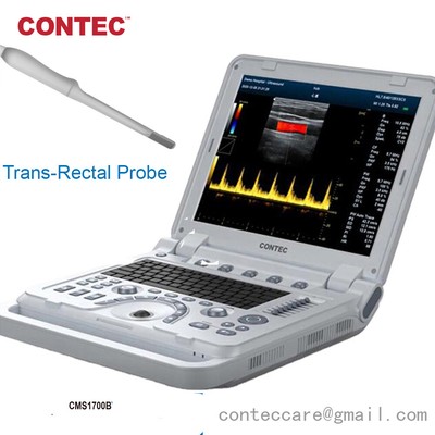 Imaging & Aesthetics Equipment - Transrectal Probe