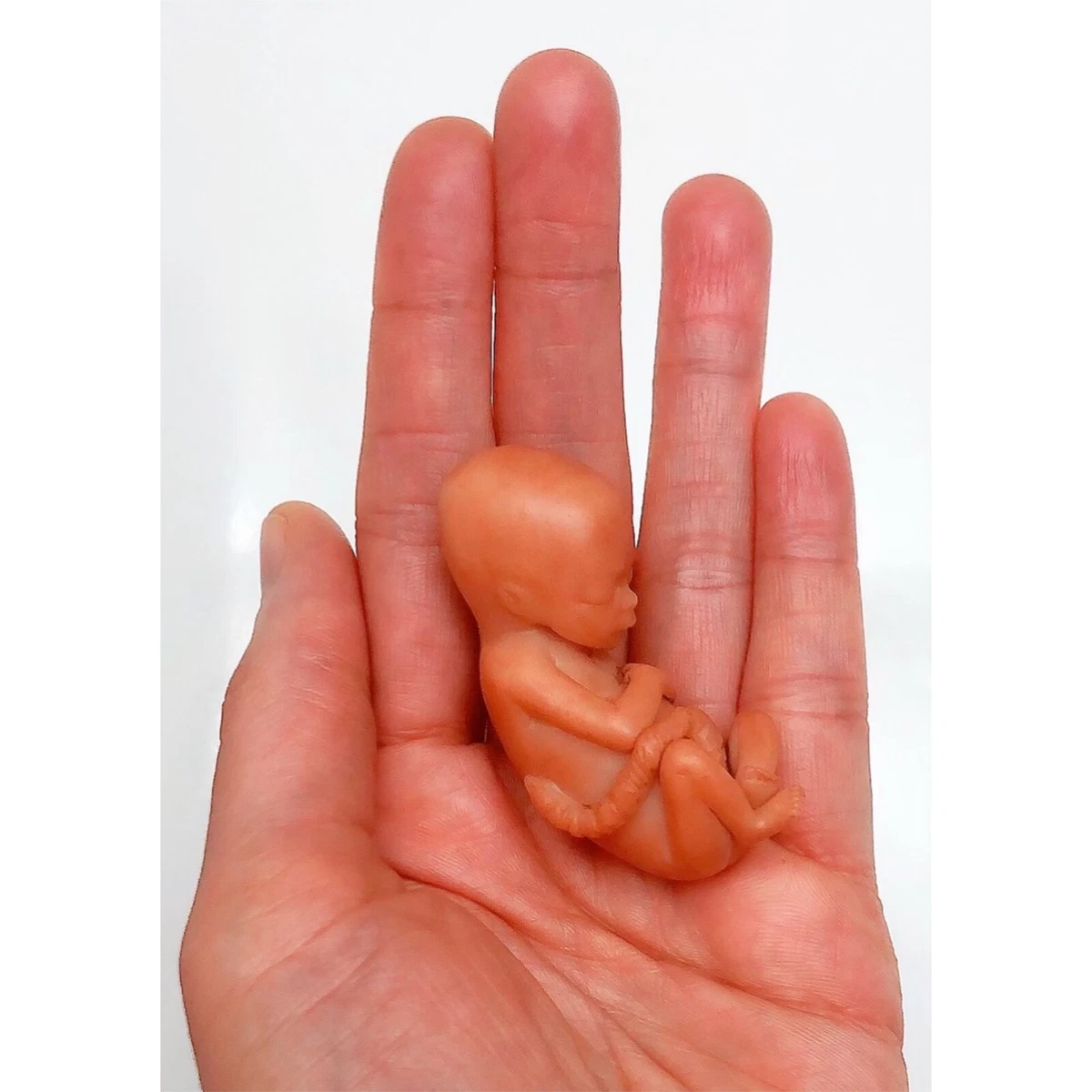 14 Weeks Baby Fetus, Stage Of Fetal Development