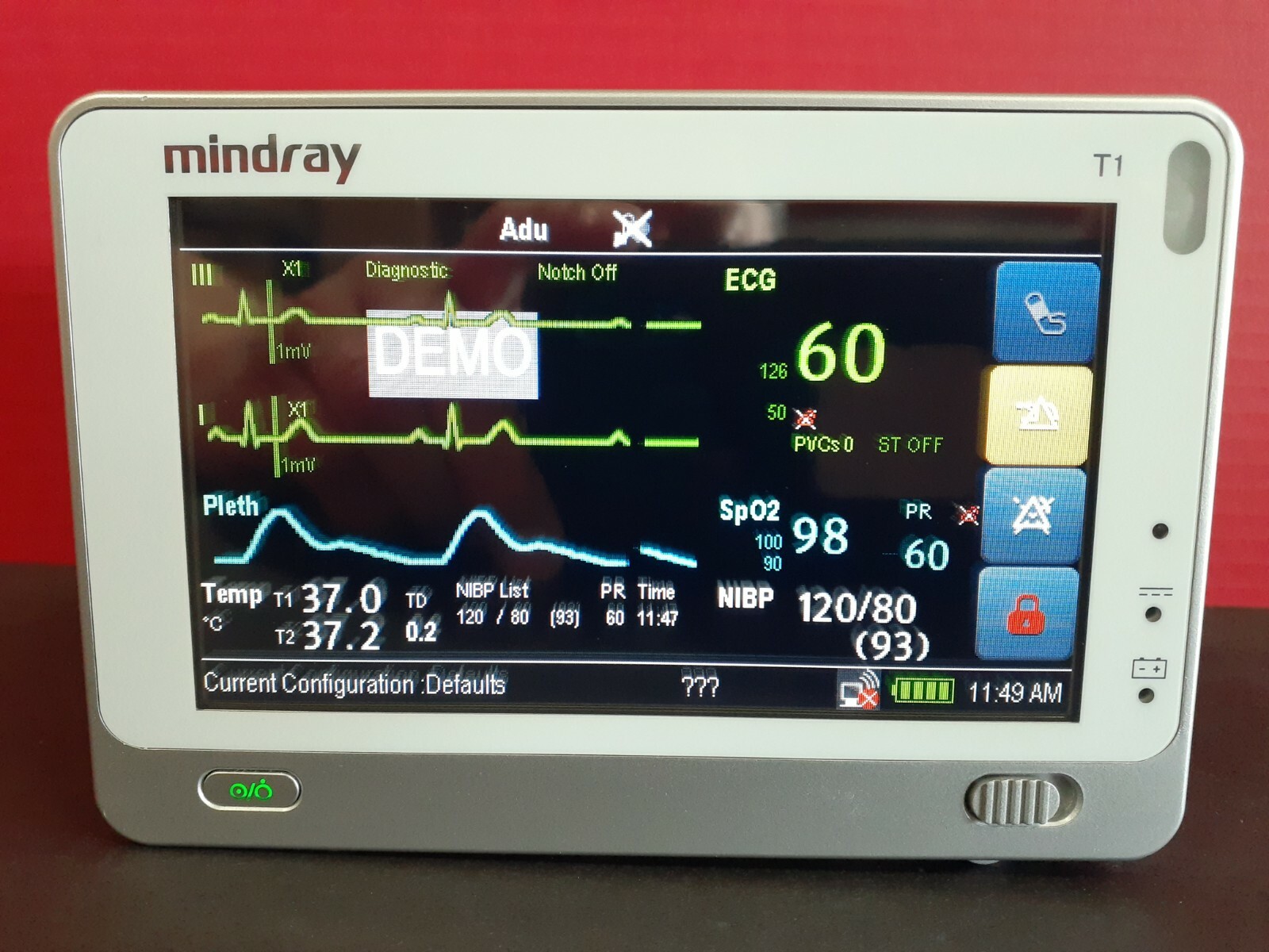 Mindray T1 - Masimo Spo2, ECG, TEMP, NIBP, Co2 Sidestream | eBay