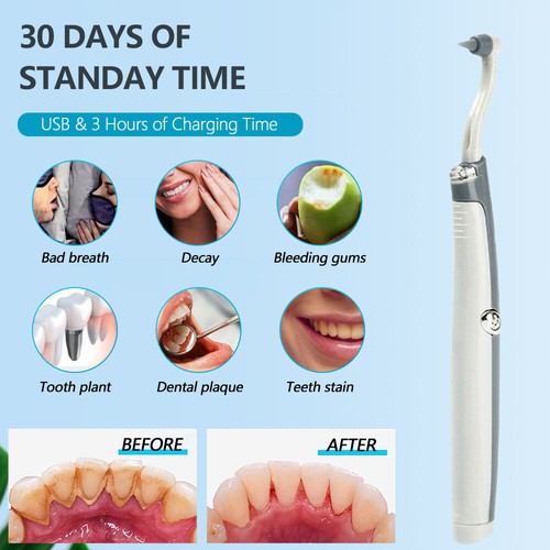 Tooth Cleaner Teeth Plaque dental Calculus Stain Remover Kit Dental ...