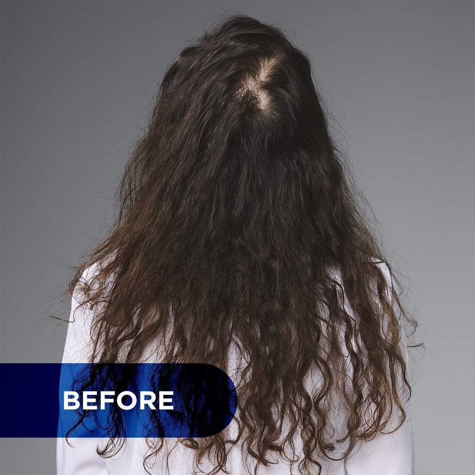 L Oreal Serioxyl Thicker Intra-cylane Hair Growth Liquid Serum 90ml / 3 ...