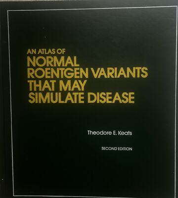 AN ATLAS OF NORMAL ROENTGEN VARIANTS THAT MAY SIMULATE DISEASE 2ND ...