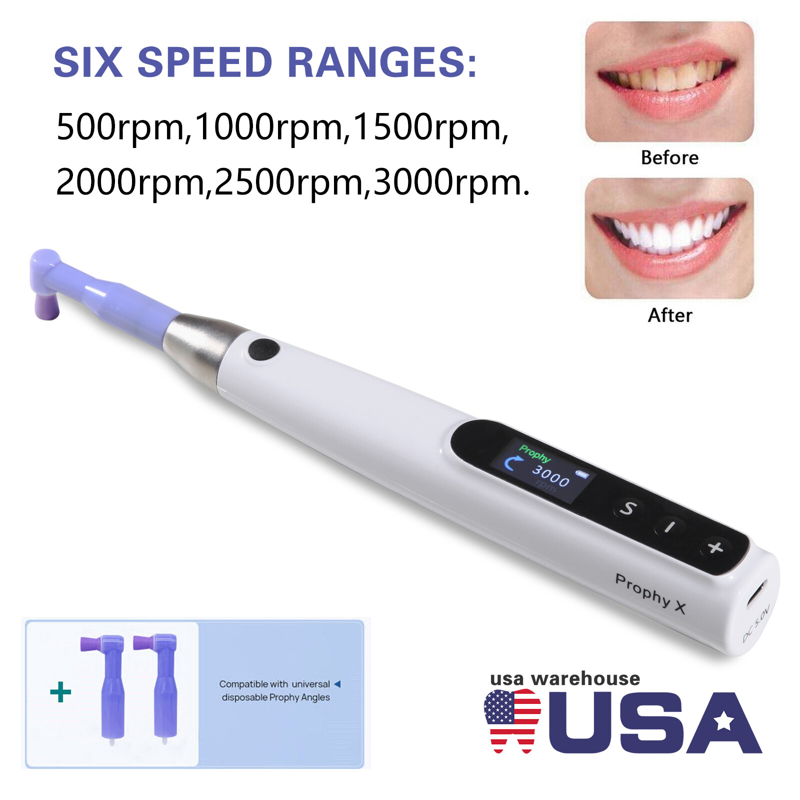 Dental Cordless Electric Hygiene Prophy Handpiece 360° Swivel+2 Prophy ...
