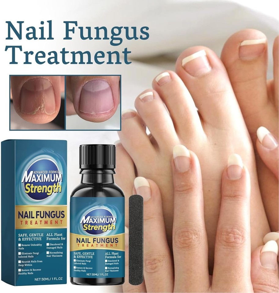 Fungal Nail Treatment - Extra Strong Nail Fungus Treatment for Toenail ...