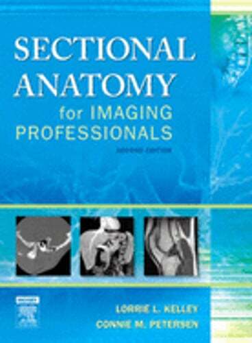 Sectional Anatomy for Imaging Professionals by Rt Kelley, Lorrie L, MS ...