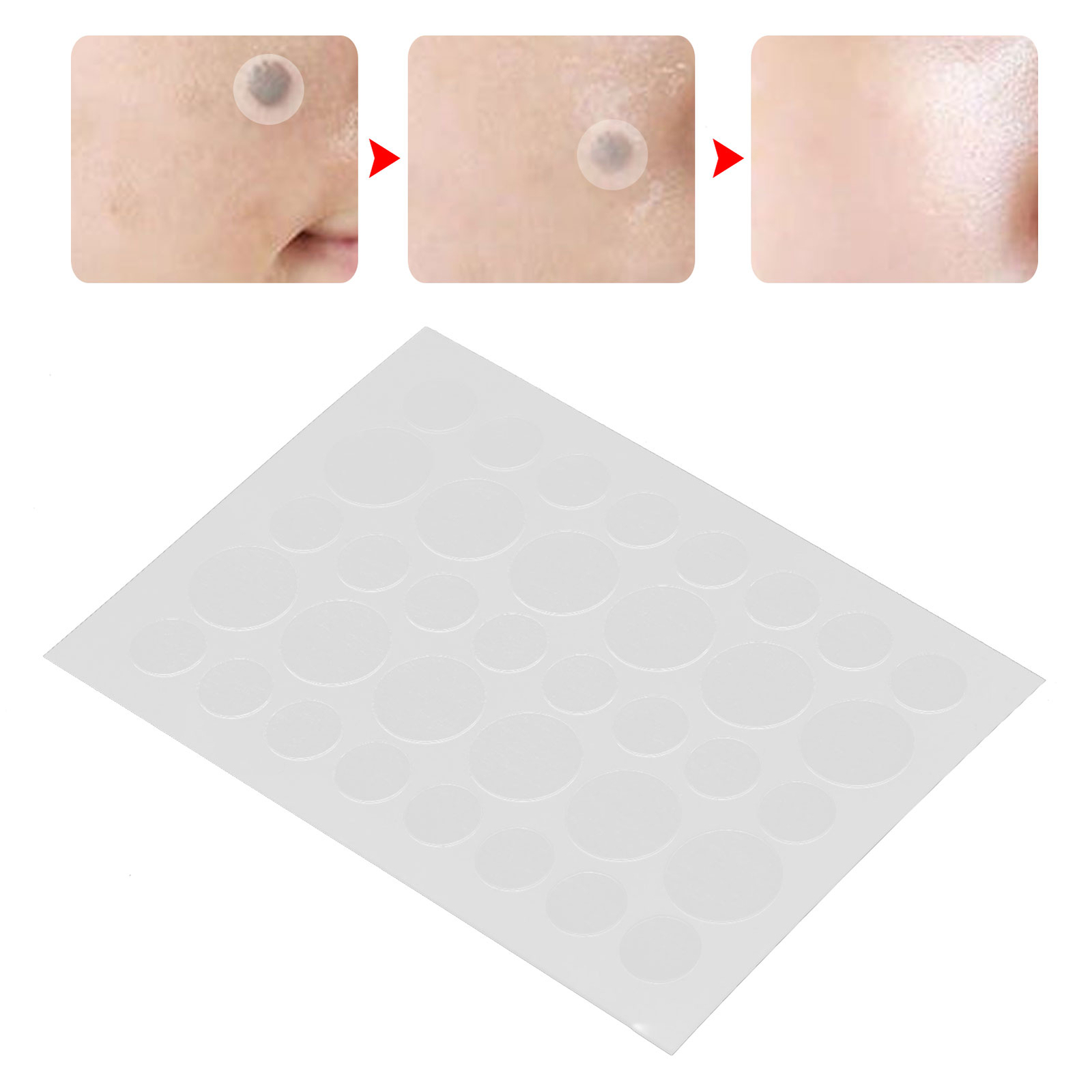 36 Patches Skin Tag Cover Patches Mole Acne Pimple Covers Concealing ...