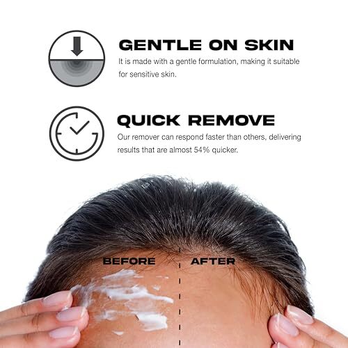 EBIN NEW YORK Wonder Lace Wig Adhesive Remover Spray - 4.05oz/ 120ml ...