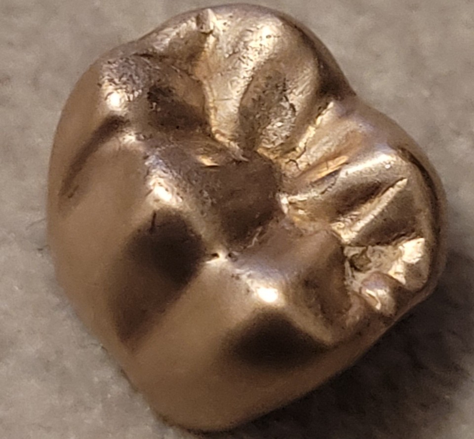 3.36g Grams Scrap Gold Dental Tooth Cap 10k or 16k from 1996. | eBay UK