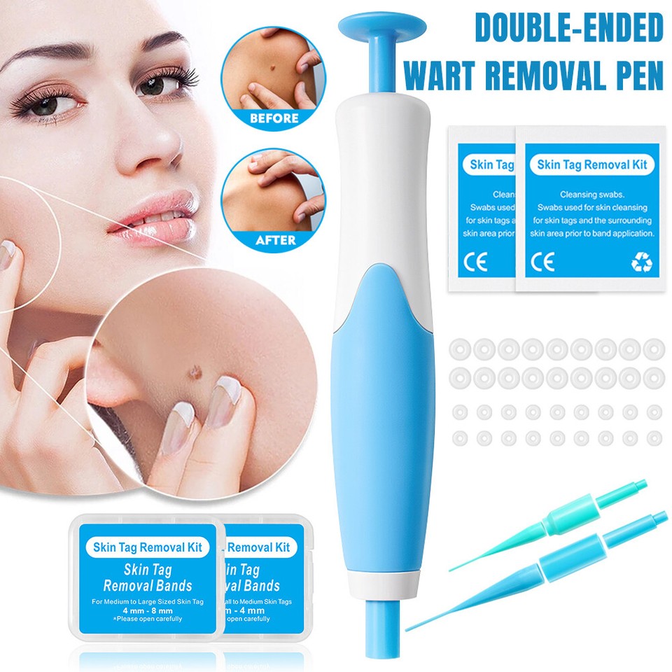 Auto Micro Skin Tag Remover Device Kit Safe Painless Mole Wart Skin Tag ...
