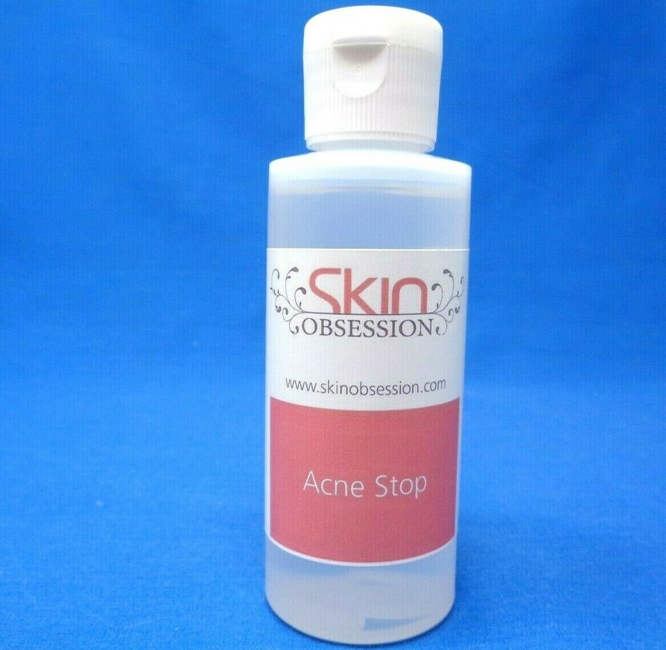 2 oz Acne Stop ~ Skin Obsession ~ Reduces Acne & Future Acne Outbreaks ...