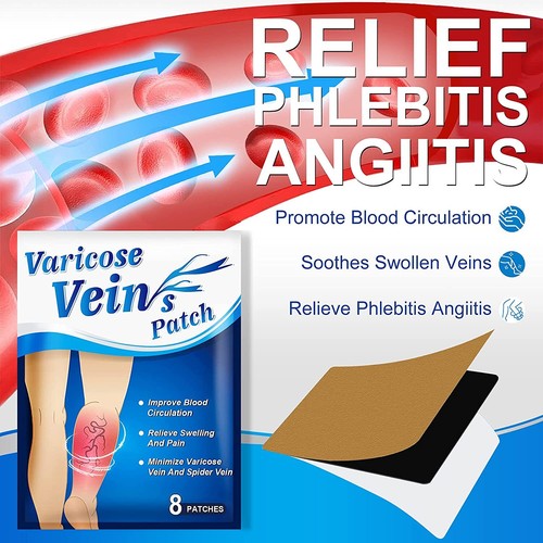 8Pcs Spider Varicose Vein Patches Relieve Leg Pain Phlebitis Angiitis ...