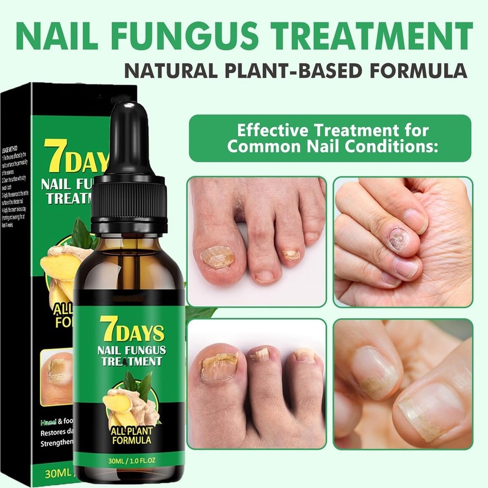Fungal Nail Treatment Strong Fungus Remover Antifungal Liquid Serum ...