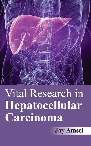 Vital Research in Hepatocellular Carcinoma (Hardback) 9781632424266| eBay