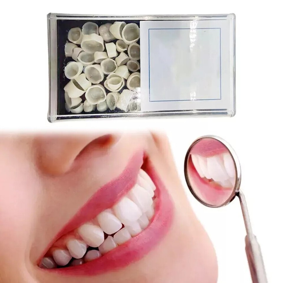2PACK Resin Anterior Back Dental Temporary Porcelain Crown Veneers ...