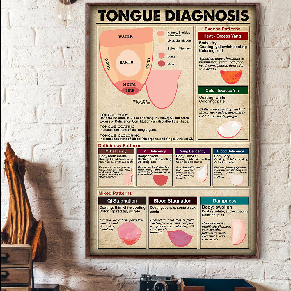 Tongue Diagnostics Chart