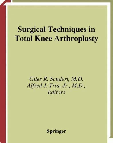 Surgical Techniques in Total Knee Arthroplasty by Alfred J. Tria Jr ...