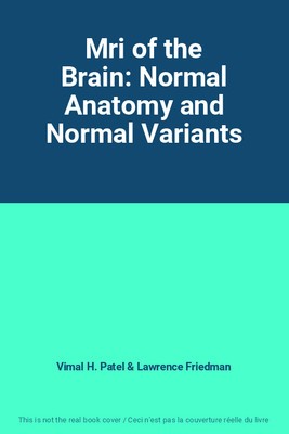 Mri of the Brain: Normal Anatomy and Normal Variants, Vimal H. Patel et ...