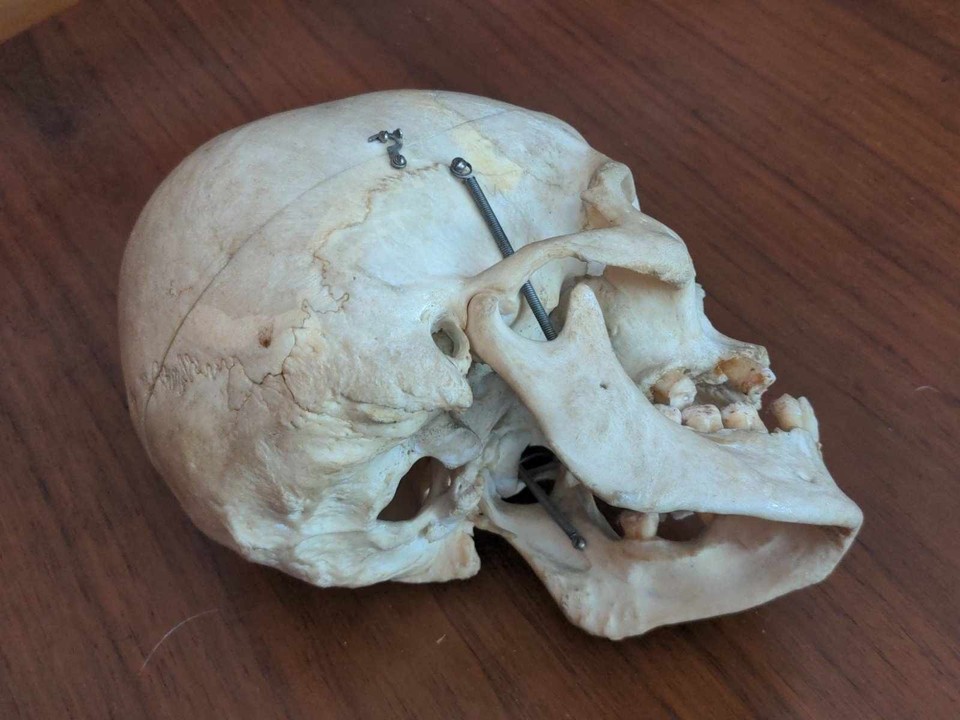 Medical Anatomical Model Human Skull Precision Working Springed Jaw ...