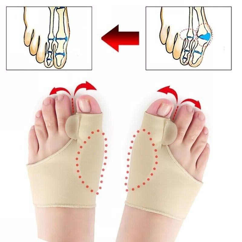 COPPIA Supporti TUTORE CORRETTORE PER ALLUCE VALGO DIVARICATORE DITA in ...