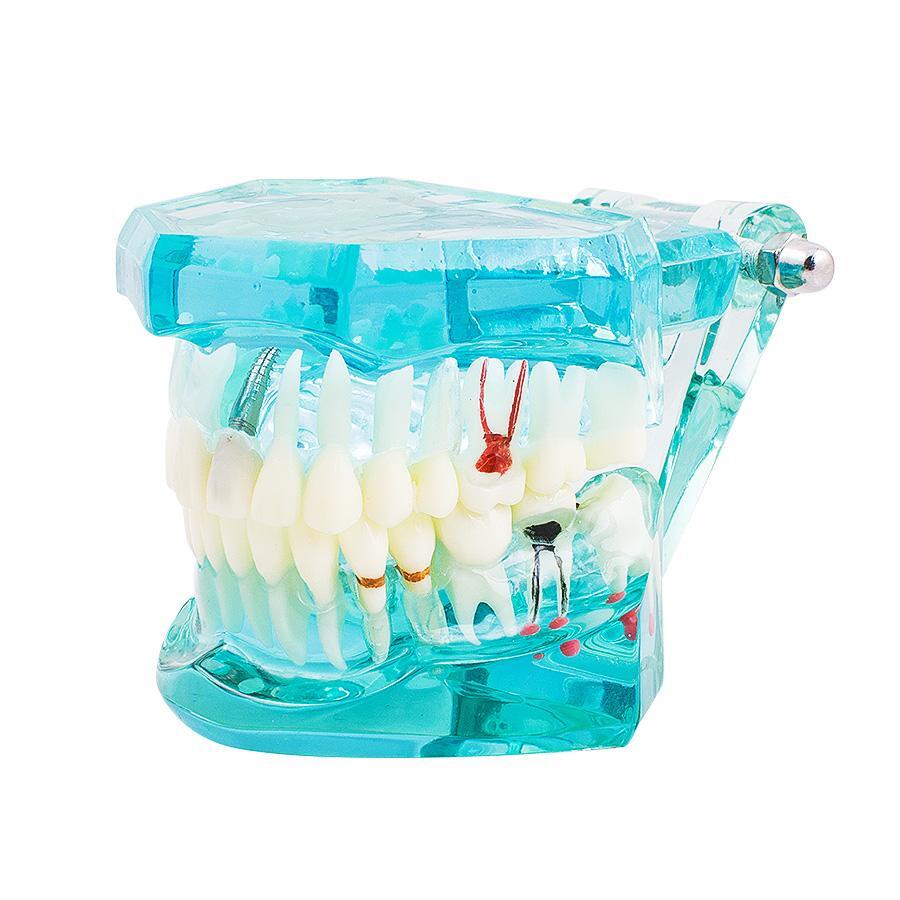 For Dental Study Model - Transparent Teeth Anatomy for Professionals ...