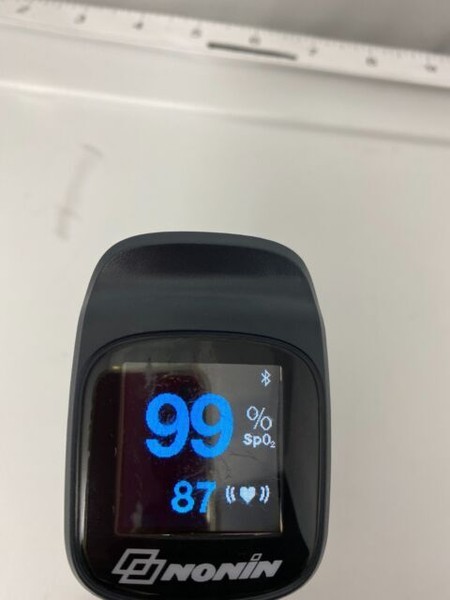 Nonin 3230 Wireless Pulse Oximeter for sale online | eBay