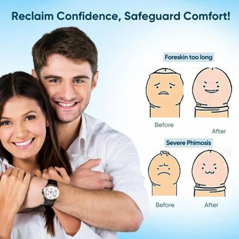 Professional foreskin correction gel for men Excess foreskin correction ...