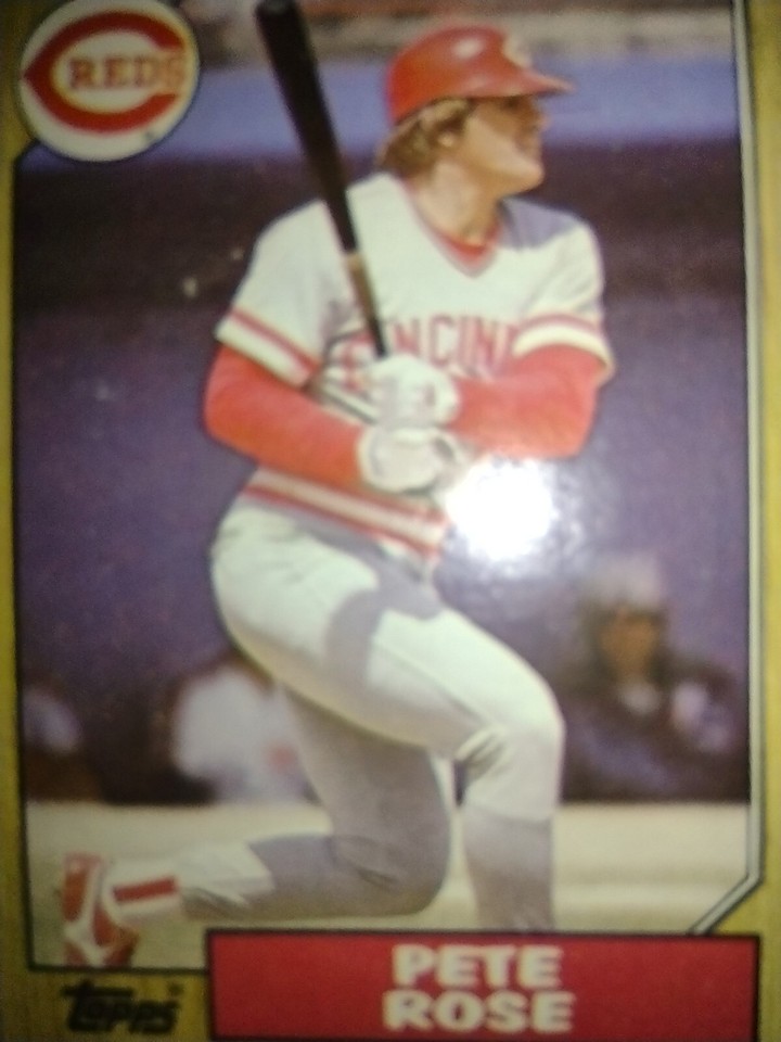 1987 Topps - #200 Pete Rose - Rare Error Card with Pink | eBay