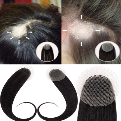Lace Cover-up Hair Patches Pieces Remy Human Hair Topper Tape for Loss ...