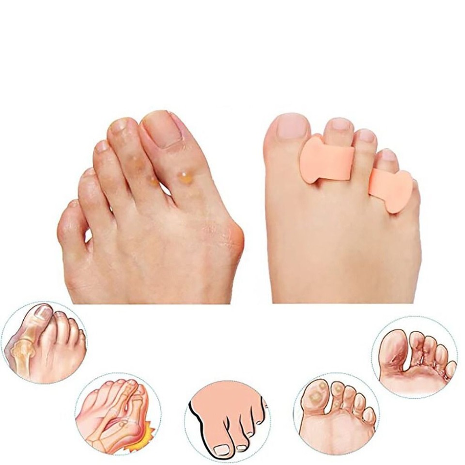 Silicone Toe Straighteners Soft Gel Toe Splints Durable Hammer Toe ...