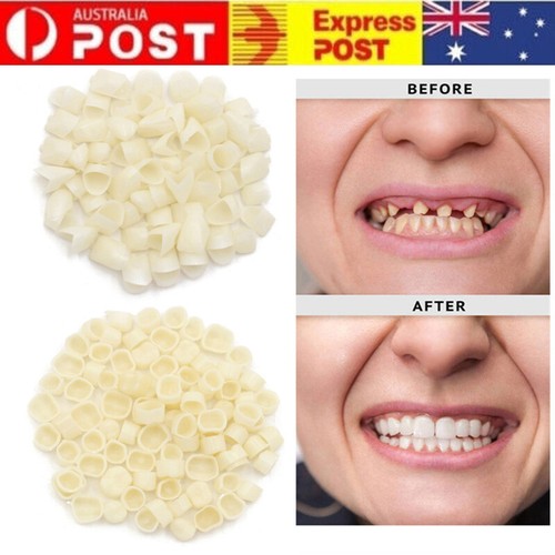 Temporary Dental False Teeth Cover Anterior Molar Front/Back Tooth ...